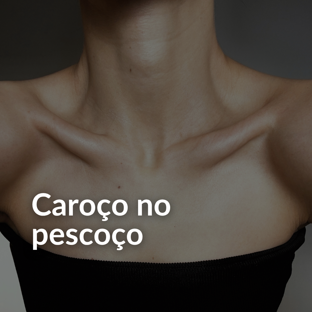 Caroço no pescoço: quando se preocupar e quando procurar um médico ...